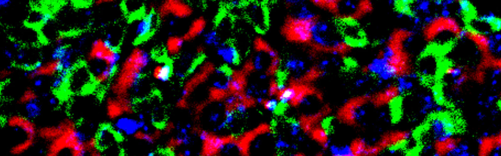 Eat less, live longer - Inside Salk