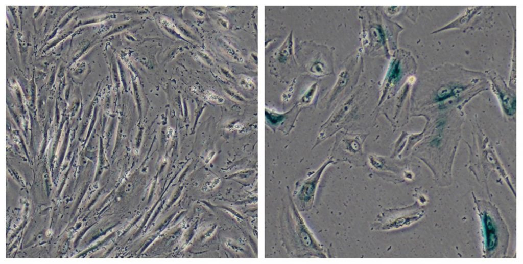 The science of aging