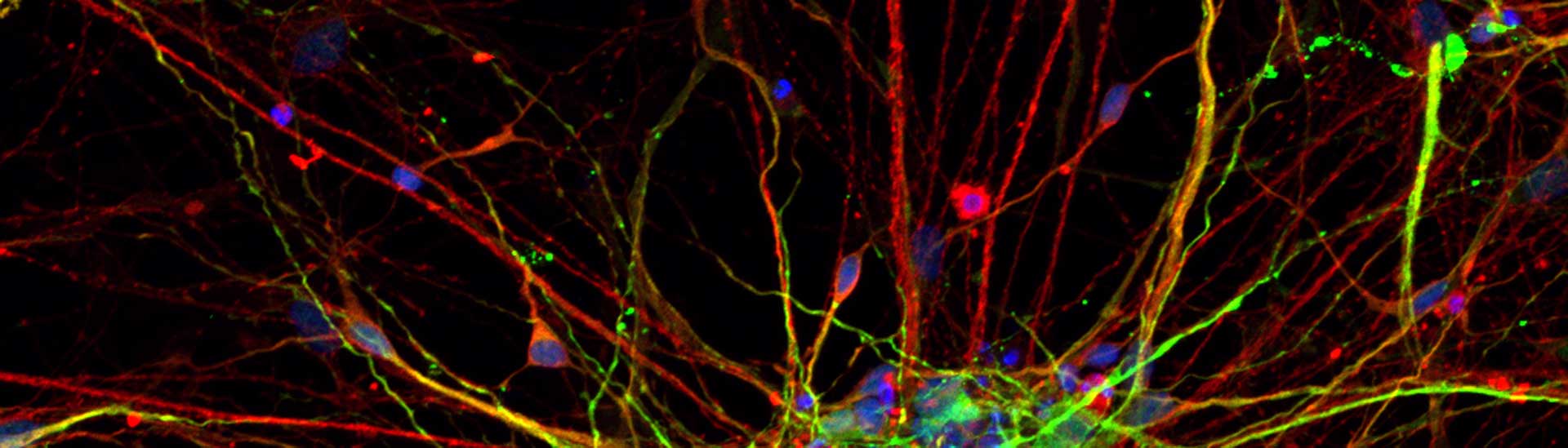 Scientists reveal clues into early development of autism spectrum ... Scientists reveal clues into early development of autism spectrum ...