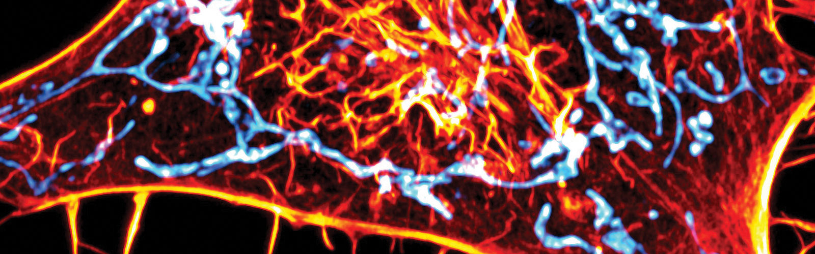 Imaging method highlights new role for cellular “skeleton” protein ...